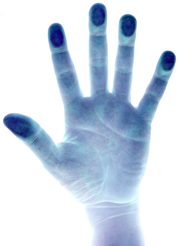 Do you have concern (privacy or other) with use palm scan reader in any ...