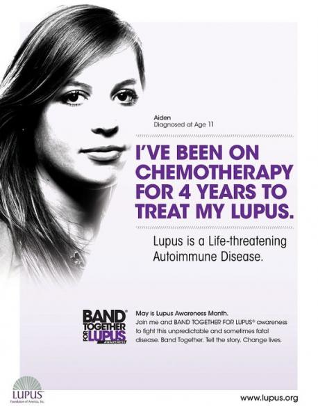 Lupus -- Things you Did Not Know About This Disease | Tellwut.com
