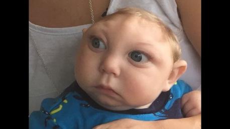 Boy With 'No Brain' Continues to Defy Expectations After Parents ...